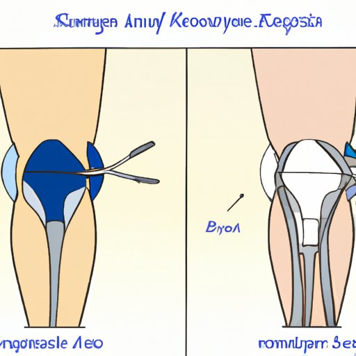 How Long Does Robotic Knee Surgery Take The Enlightened Mindset How Long Does Robotic Knee Surgery Take The Enlightened Mindset
