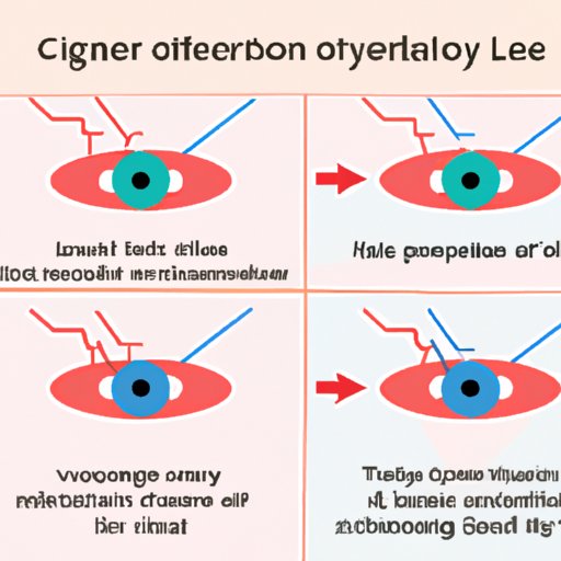 The History Of Laser Eye Surgery A Journey From Inception To Today The History Of Laser Eye Surgery A Journey From Inception To Today