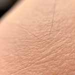 How Deep Does a Cut Have to Be to Scar? – Exploring the Science Behind ...