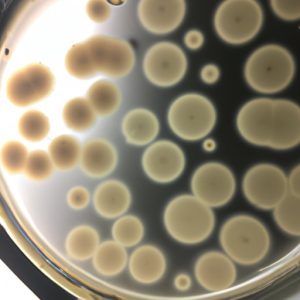 What is Bacterial Culture? Exploring the Different Types and Uses - The ...