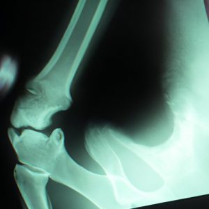 Who Invented the X-Ray? A Timeline of X-Ray History - The Enlightened ...